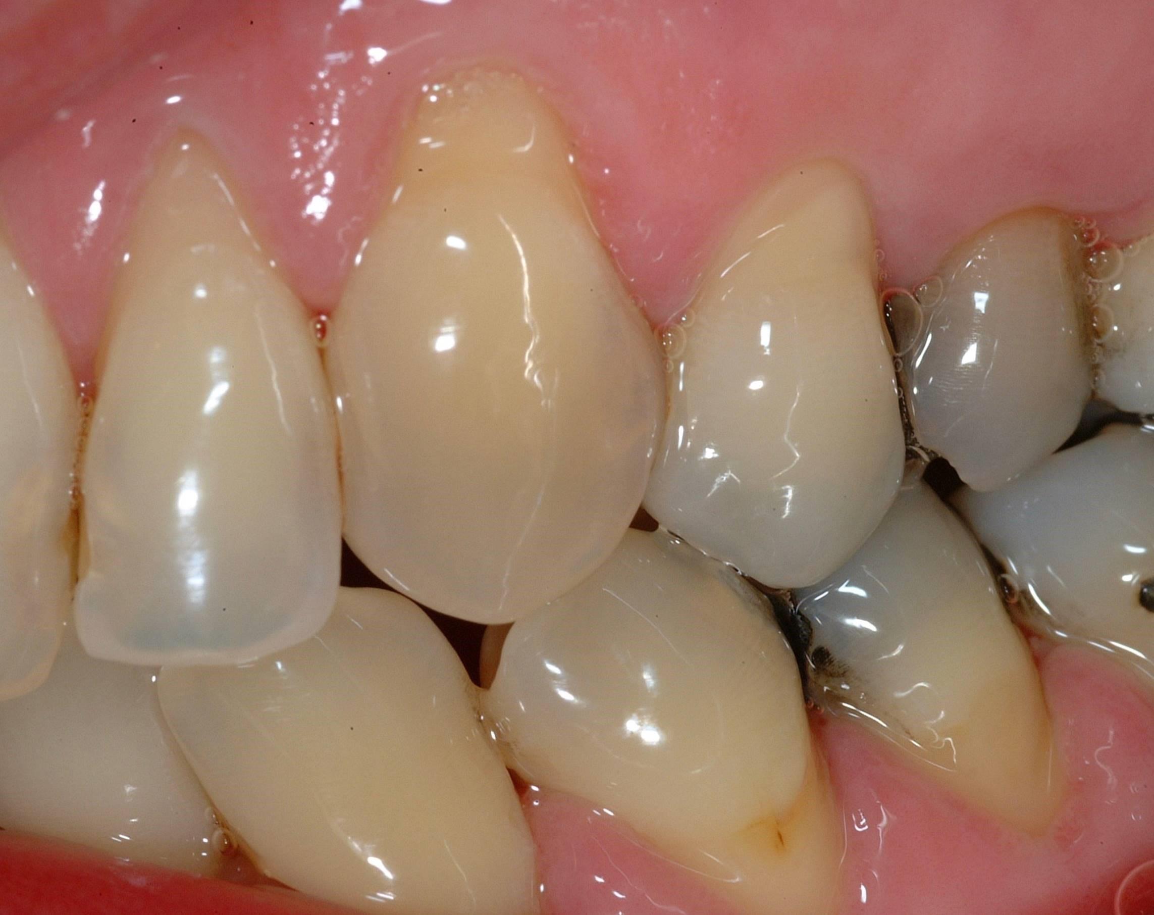 G-BOND™ | GC Europe N.V.