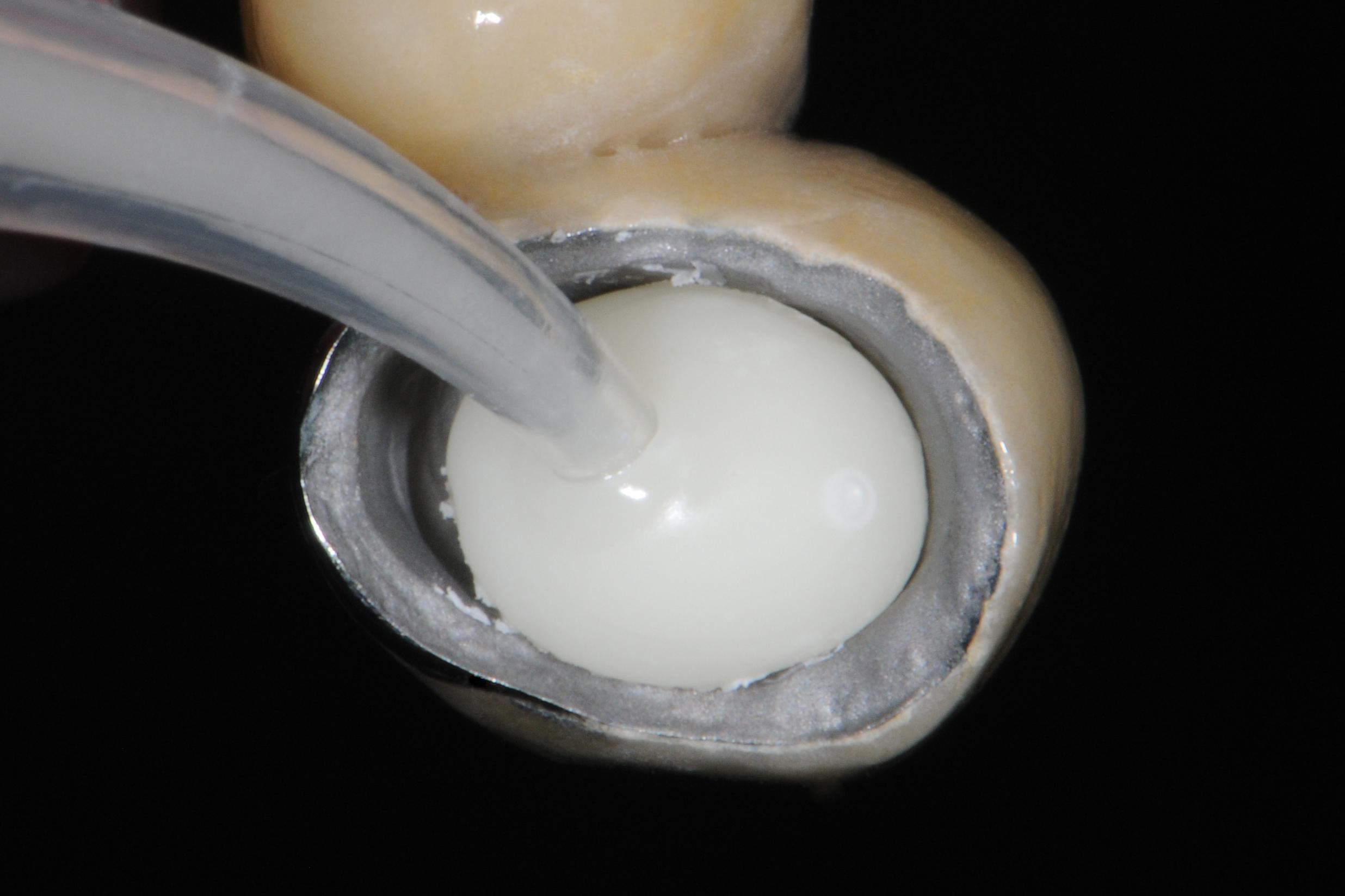 Fuji PLUS (EWT) | GC Europe N.V.