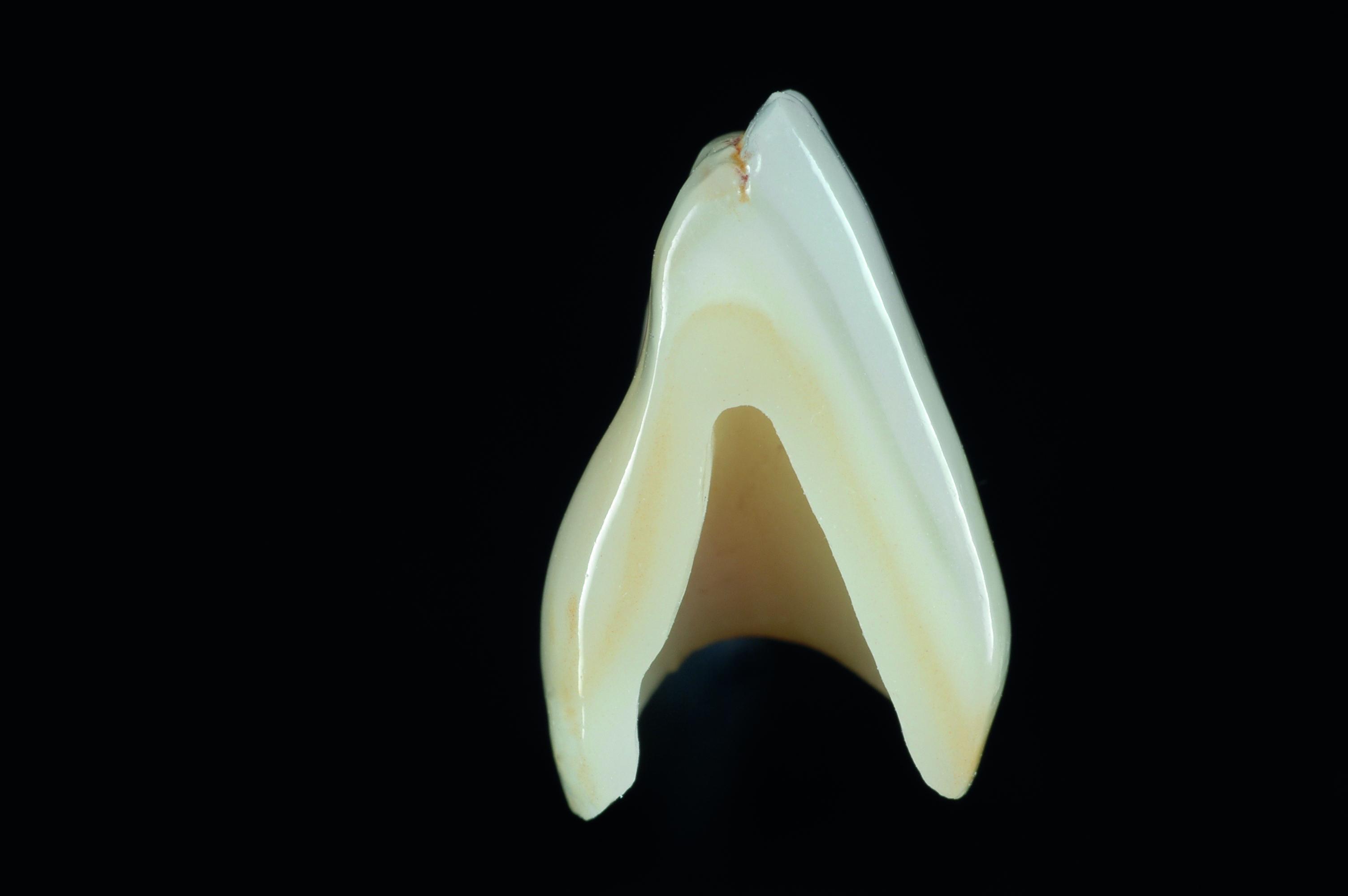 Initial Ceramics | GC Europe N.V.