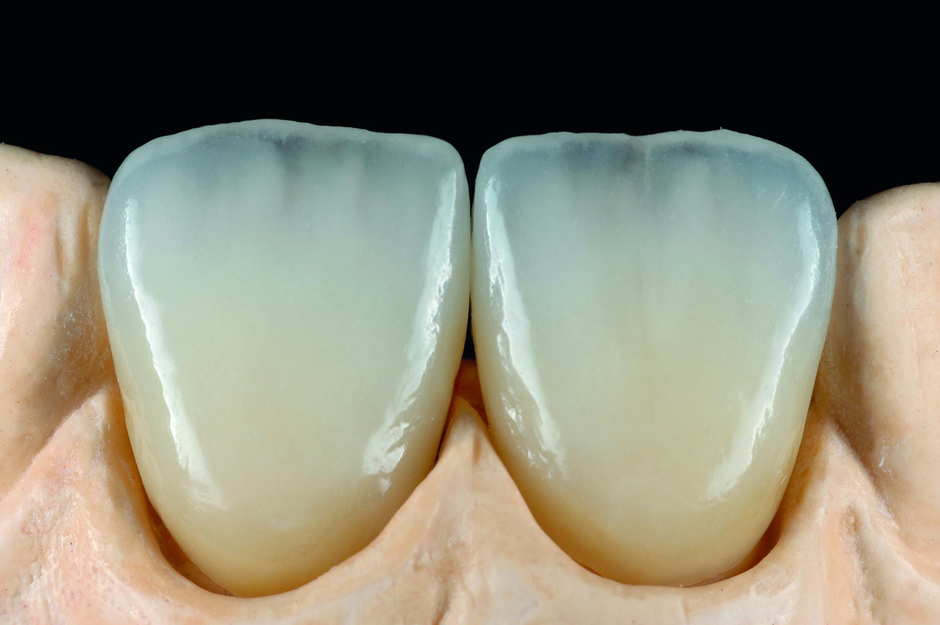 Initial Ceramics | GC Europe N.V.