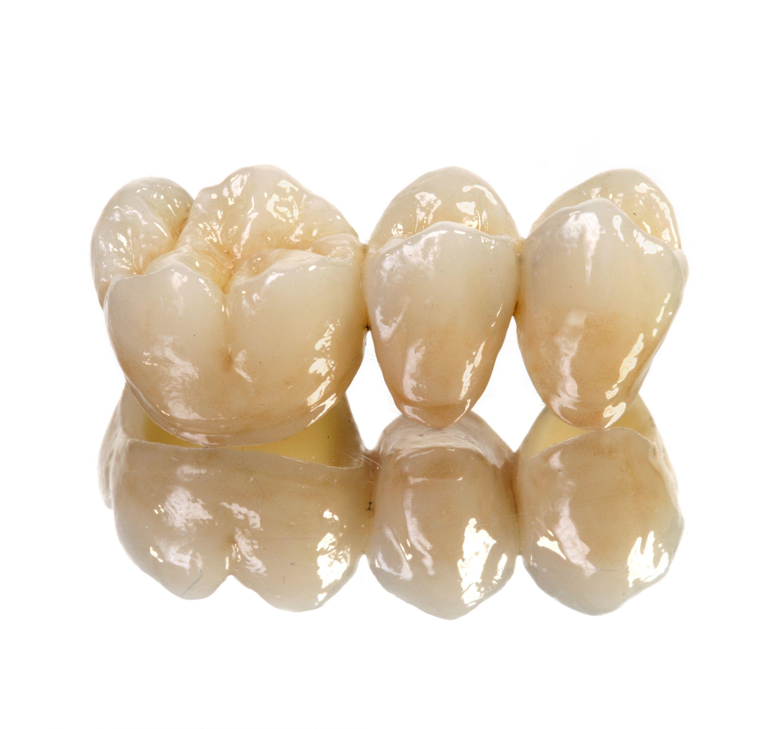 Initial Ceramics | GC Europe N.V.