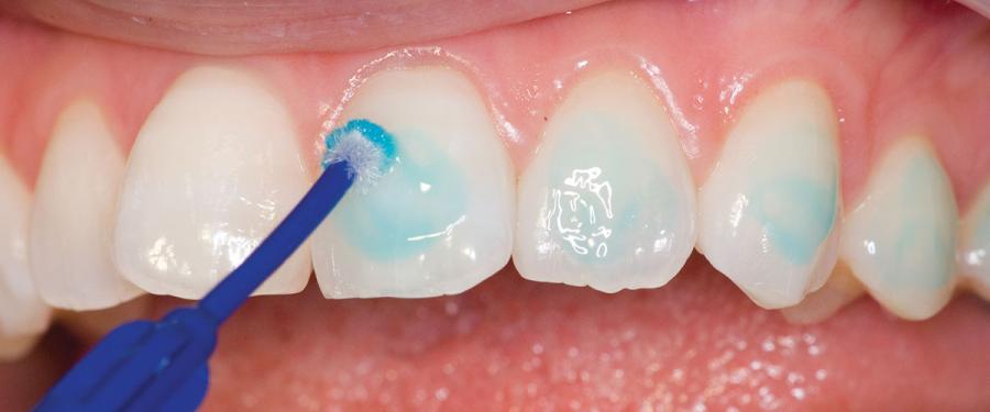 ORTHO GEL CONDITIONER | GC Europe N.V.